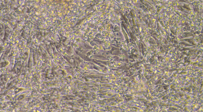 Duke-NUS researchers develop promising stem cell-based regenerative ...